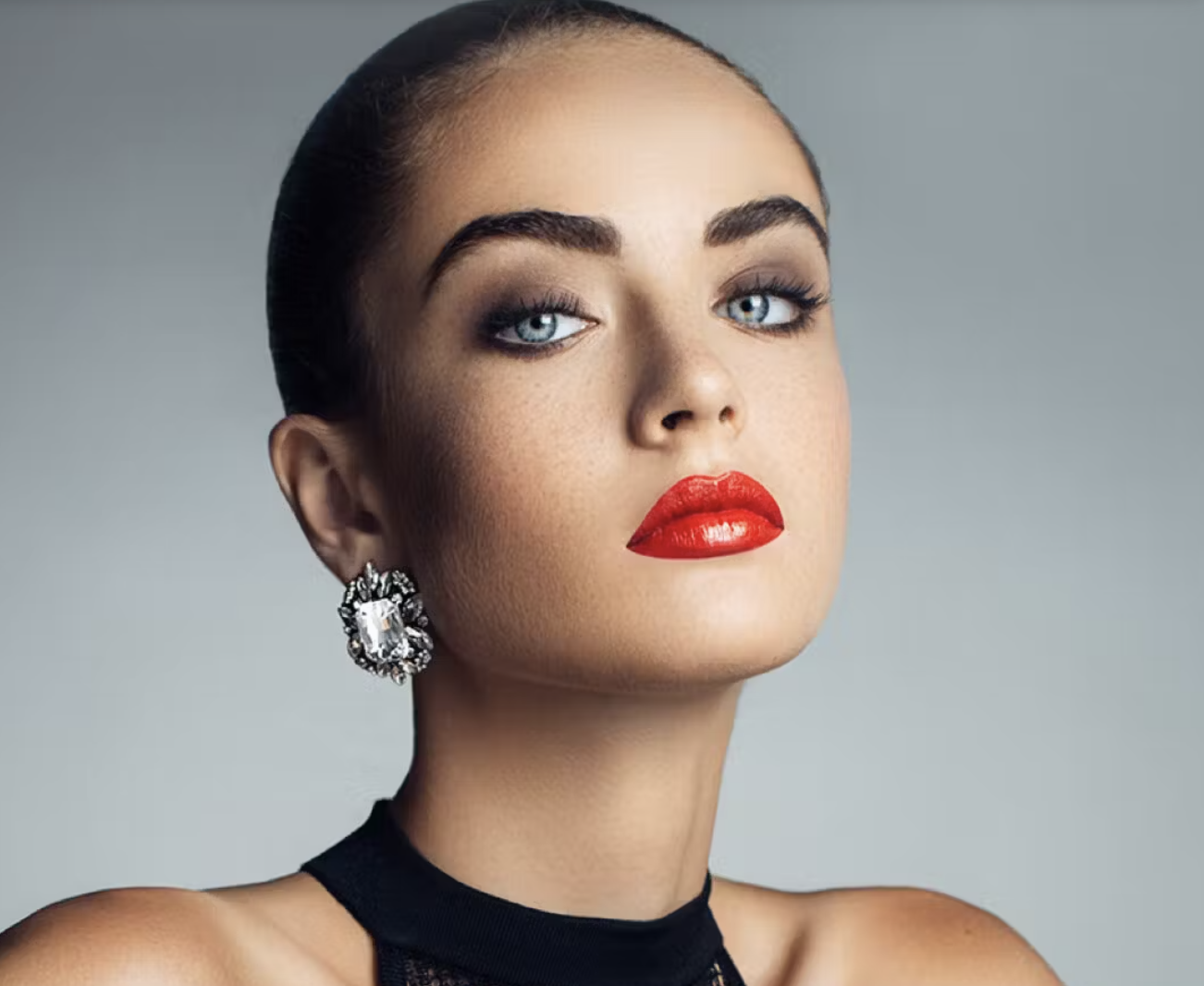 Non Surgical Rhinoplasty – Fresh Aesthetics Solihull